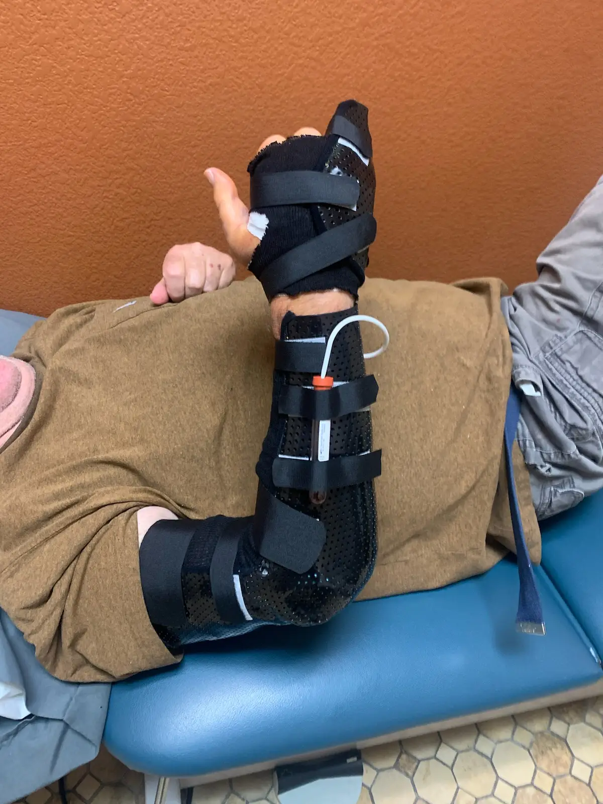 Hand Splints | Optimal Therapy | Physical Therapy and Occupational ...